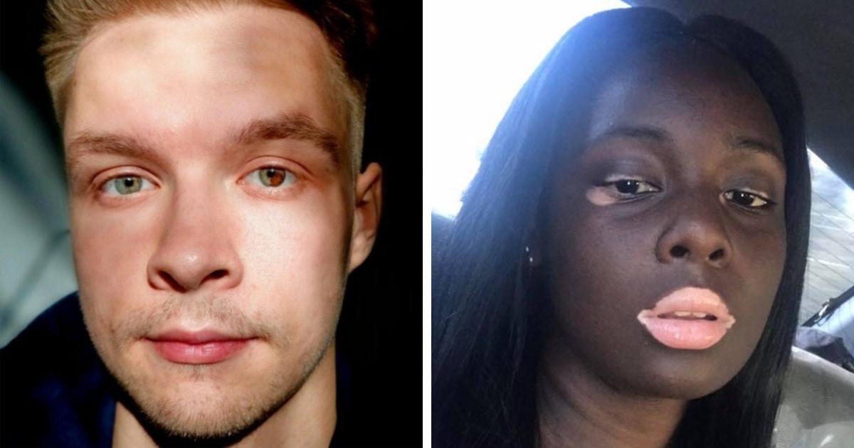 ROĐENI DA BUDU DRUGAČIJI: 15 fotografija ljudi koji imaju neobične crte ...
