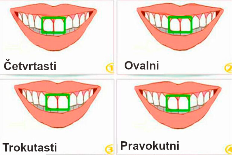 KAKVI SU VAM ZUBI? Odaberite vaš oblik i pročitajte rezultat ...